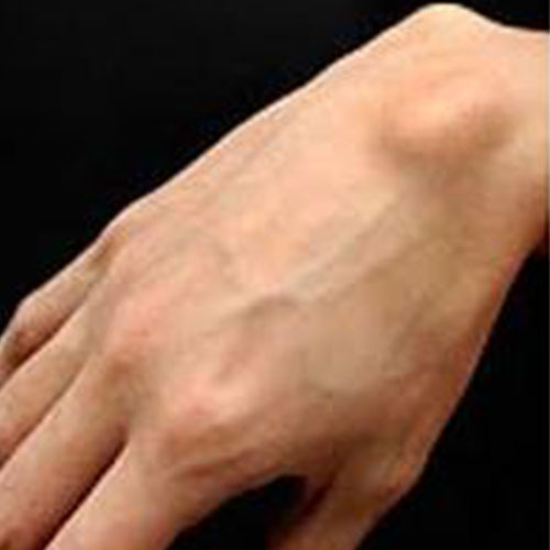 CARPAL BOSS - Texas Orthopedic and Spine Associates